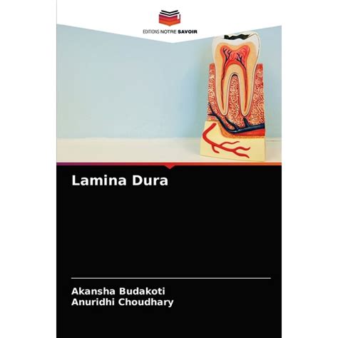 Lamina Dura The Lore And The Lure O The Lamina Dura