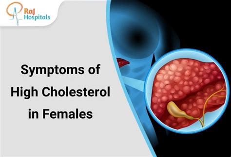 Symptoms Of High Cholesterol In Females Raj Hospitals