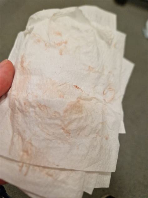 Implantation Bleeding 11dpo Pinkish Orange Spotting When I Wipe I