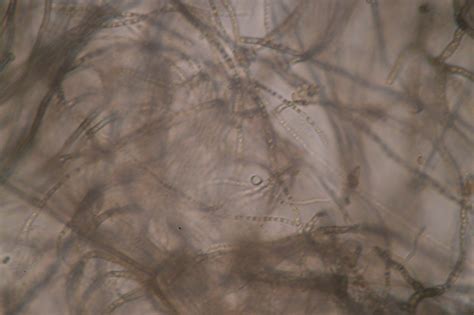 Questions With Answers In MYCELIUM Science Topic