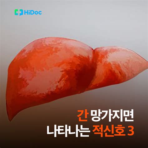 간이 안 좋을 때 나타나는 위험 증상 3 카드뉴스 건강정보 성가롤로병원