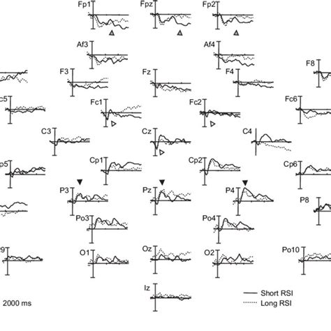 Difference Waves Intrusion Error Incongruent Correct For 42 Scalp
