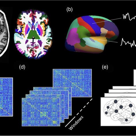 Overview Network Analyses Pipeline A High‐resolution Structural Download Scientific Diagram