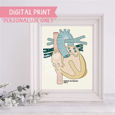 Truncus Arteriosus Type 2 Digital Print Anatomical Heart Illustration