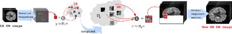 Figure From A Multiscale Sparse Representation For Diffusion Weighted Imaging DWI Super