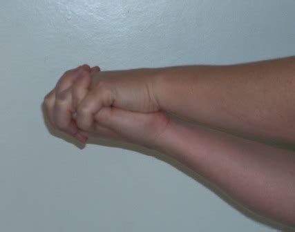 Arm Passive Range Of Motion For Stroke Patients