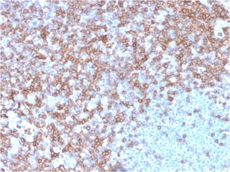 Cd43 T Cell Marker Monoclonal Antibody Spn 3388 6693 Msm11 P0