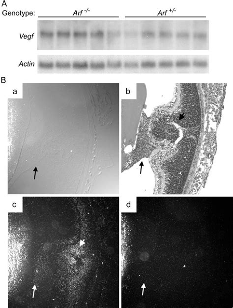 Figure 1 From Pathogenesis Of Persistent Hyperplastic Primary Vitreous In Mice Lacking The Arf