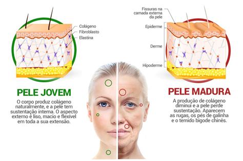 7 Different Types Of Wrinkles And 4 Tips For Treating Them Artofit