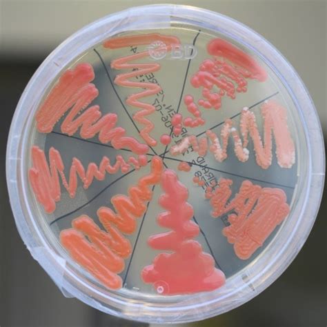 Pdf Rhodotorula Spp In The Gut Foe Or Friend