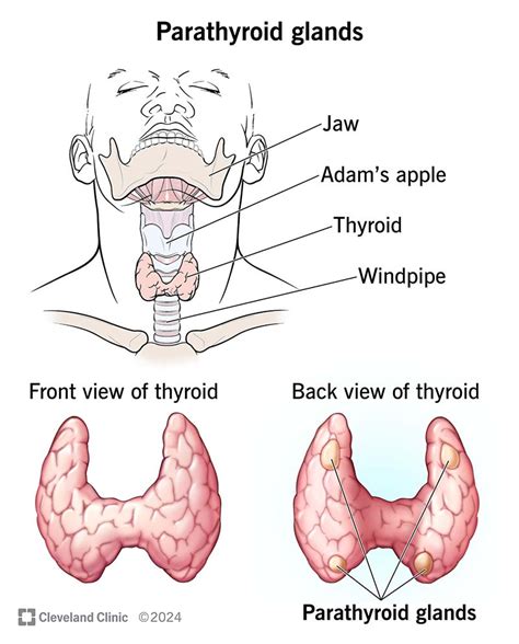 Parathyroid Disease