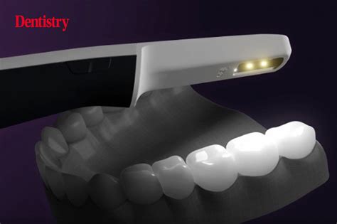 What Do Dentists Think Of The Itero Lumina Scanner Dentistry