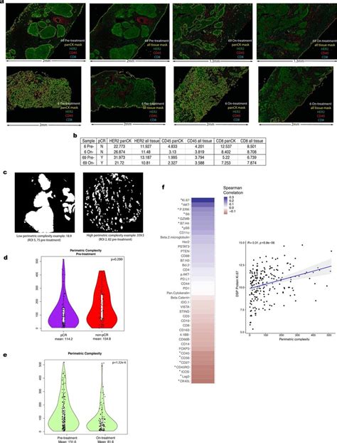 Multiplex Immunohistochemistry And Perimetric Complexity A Multiplex Download Scientific