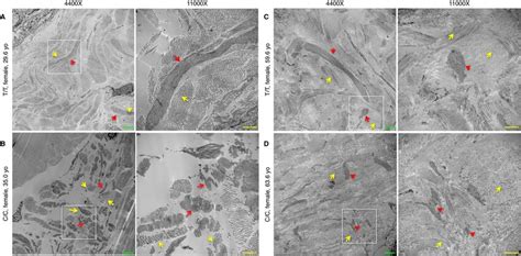 Electron Microscopy Of Fibrillin 1 In Skin A C Electron Microscopy