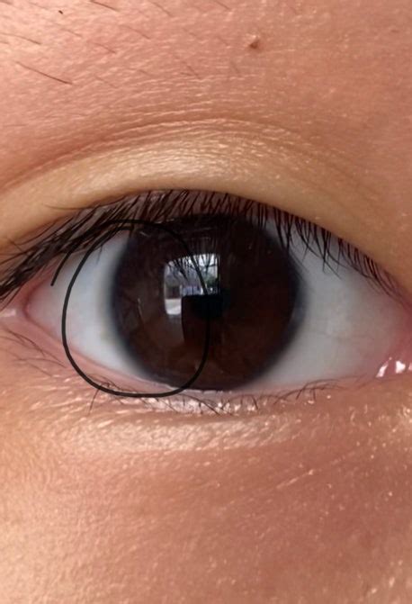 눈 건강 질문 지식in