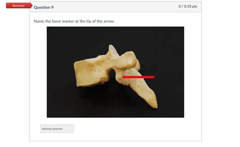 Solved Question 9 ﻿i Tried Spinous Process But It Was