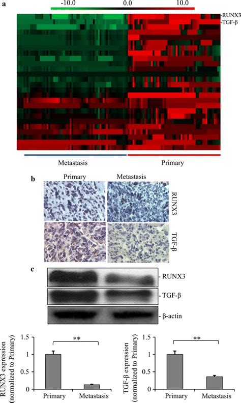Dna Methylation Affects Metastasis Of Renal Cancer And Is Associated