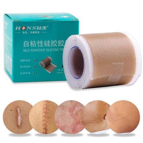 실리콘 흉터 패치 상처 밴드 여드름 화상 흉터 치료 커버 귀 교정기 효율적인 복구 손상된 피부 시트 4x50cm세트