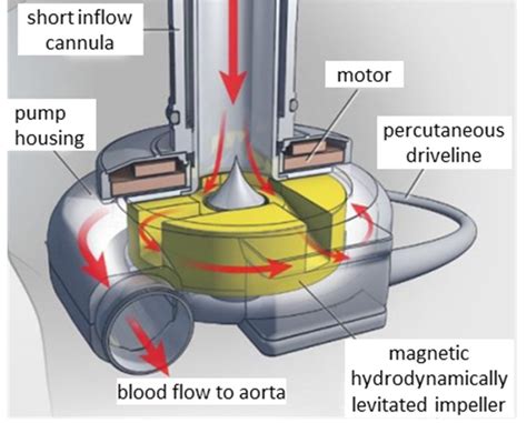 Pump Types For Lvad And Tah Applications A Centrifugal Flow With A