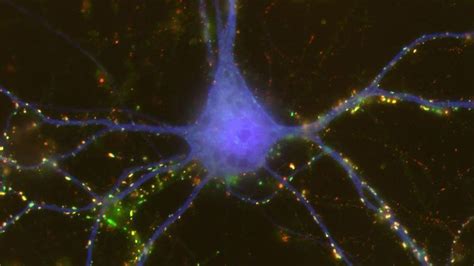 Sex Differences May Influence How Brain Cells Connect Technology Networks