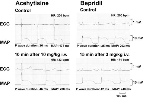 Typical Traces Showing The Surface Lead Ii Electrocardiogram Ecg And