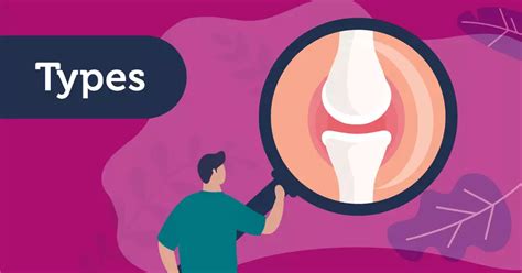 Lupus Support Online Lupus Social Network Mylupusteam