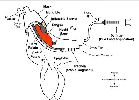 Figure 1 From Role Of Surgical Hyoid Bone Repositioning In Modifying Upper Airway Collapsibility