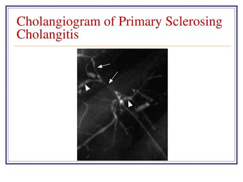Ppt Abnormal Lfts Powerpoint Presentation Free Download Id139175
