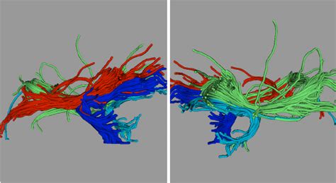 automatic clustering of sets of streamlines into four main groups which