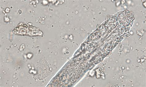 Microscopic Parasites In Humans