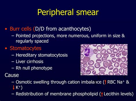 Anemia Classification Pathogenesis Ppt