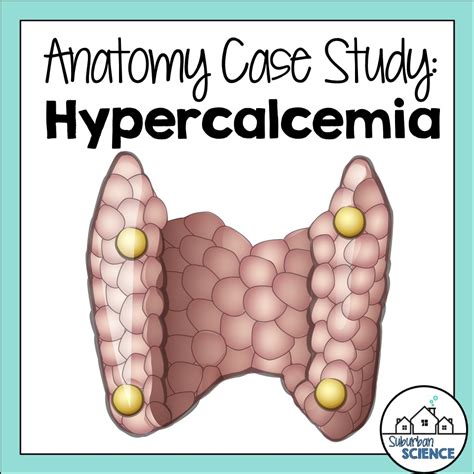Anatomy Case Study Hypercalcemia Suburban Science