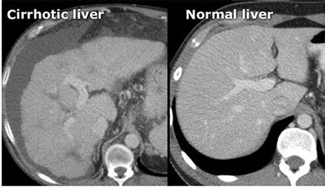 7 Stories Of Liver Count And Health