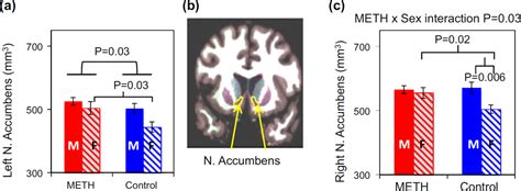 Sex Differences In Impulsivity And Brain Morphometry In Methamphetamine Users Pmc