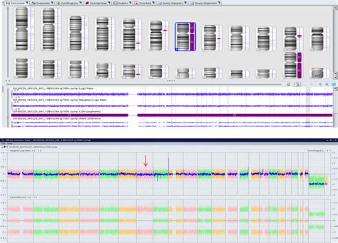 The Molecular‐cytogenetic Analyses Of The Proband By Affymetrix