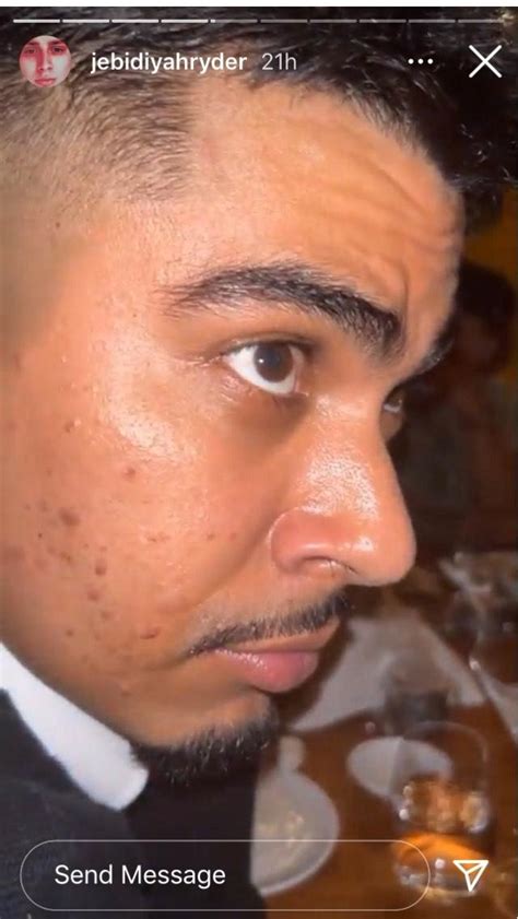 Blazzys Slowly Morphing Into Spongebob🧽🍍 Rnojumper