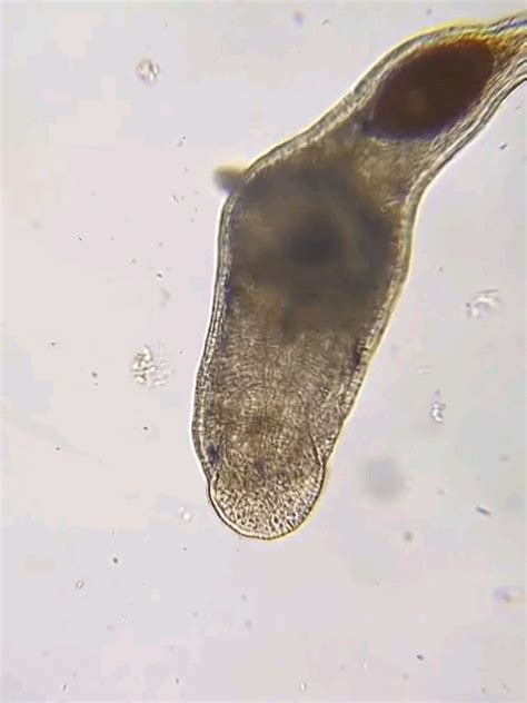 Freshwater Flatworm Hunting Single Celled Organisms Eating Them And