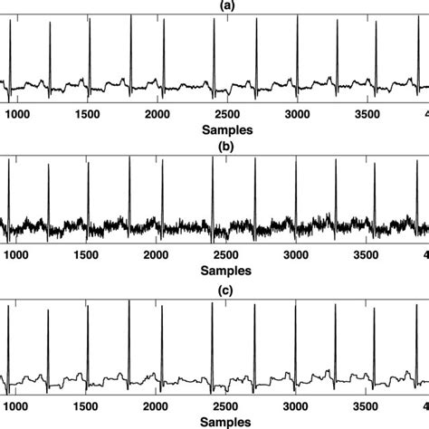 A Clean Ecg Signal Ecg Record No 100 M B Noisy Ecg Signal Snr