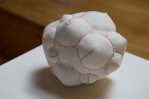 Bipolar Disorder The Truth Behind Self Binding Directives