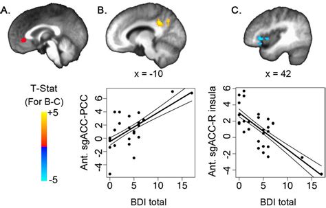 Subclinical Depression Severity Is Associated With Distinct Patterns Of Functional Connectivity