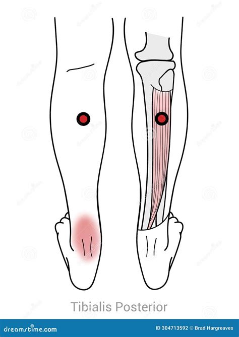 Tibialis Posterior Stock Illustration Illustration Of Heel 304713592