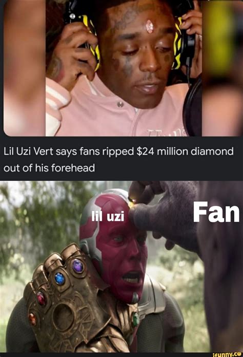 Lil Uzi Vert Says Fans Ripped 24 Million Diamond Out Of His Forehead