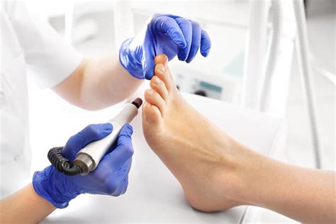 What Are Foot Corns And How To Treat Them Red Mountain Footcare