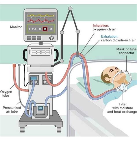 A Flow Diagram To Show The Process Of Ventilation Expiratory
