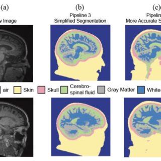 Example Of Tissue Segmentation Using Pipeline And Pipeline Aleft Download Scientific