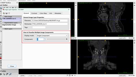How To Extract Multiple Components Image From Dicom Series Beginner Questions ITK
