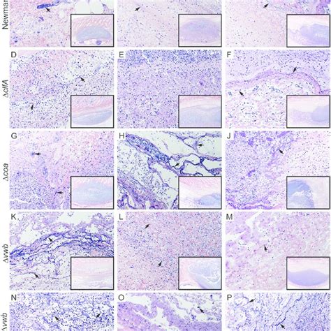 Histopathology Of Rabbit Skin Abscess Caused By S Aureus