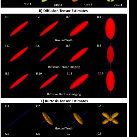 Pdf Diffusional Kurtosis Imaging In The Diffusion Imaging In Python Project