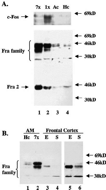 Differential Effects Of Single And Repeated Immobilization On The Download Scientific Diagram