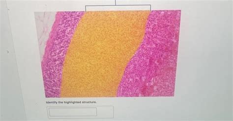 Solved Name The Highlighted Cells Identify The Highlighted